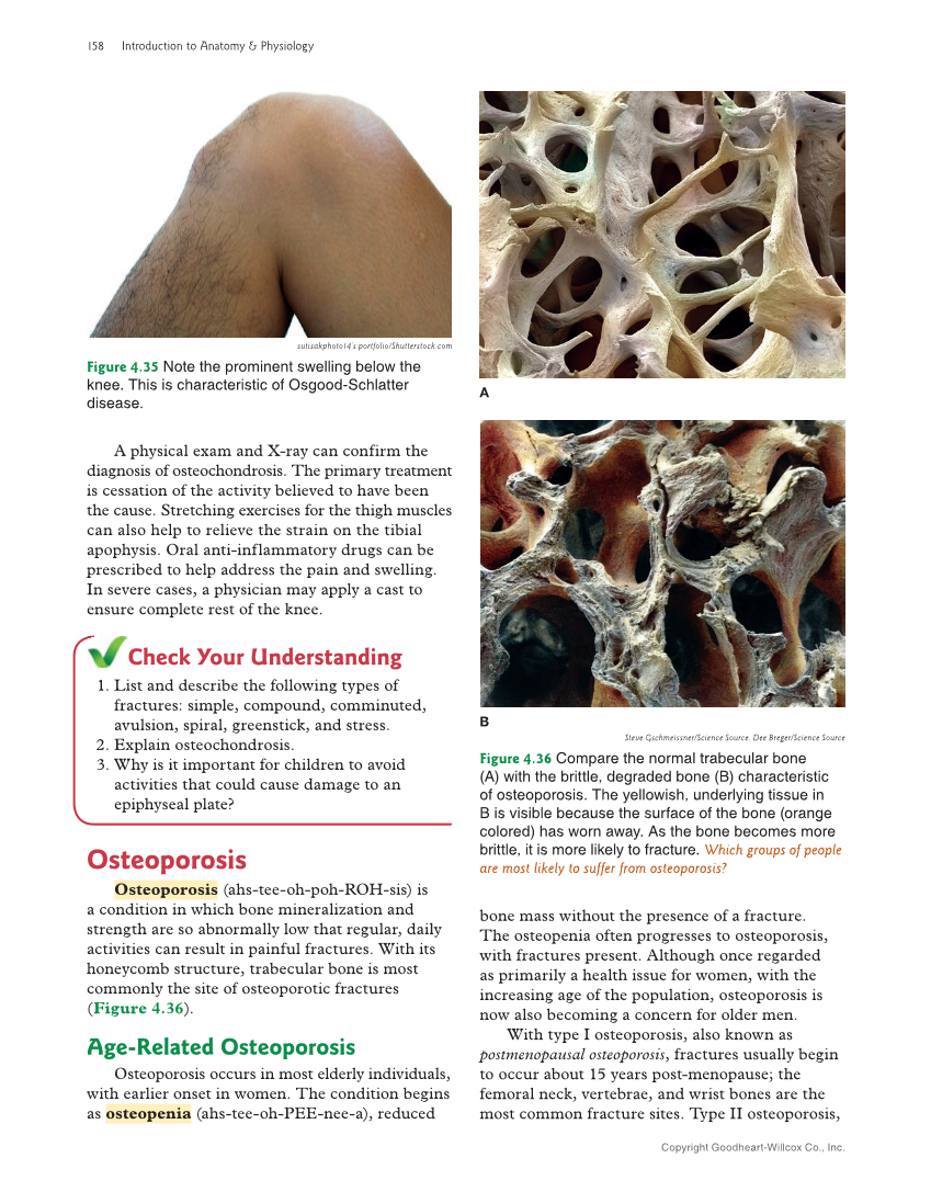 Introduction To Anatomy And Physiology 2nd Edition Page 158 introduction-to-anatomy-and-physiology-2nd-edition-page-158